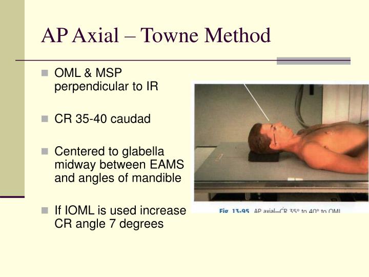 PPT - Mandible & TMJ Lecture PowerPoint Presentation - ID:292789
