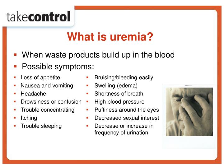 PPT - Pre-Dialysis Education Understanding Your Treatment Options ...