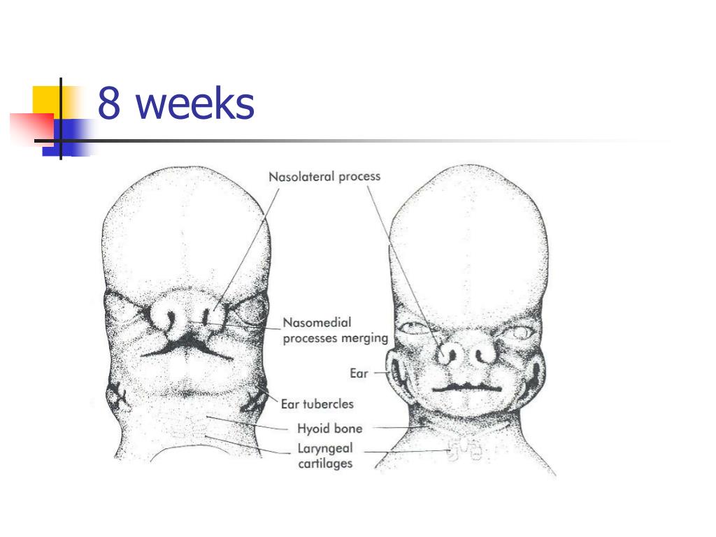 PPT - Embryology of the Neck & Neck Masses PowerPoint Presentation - ID ...