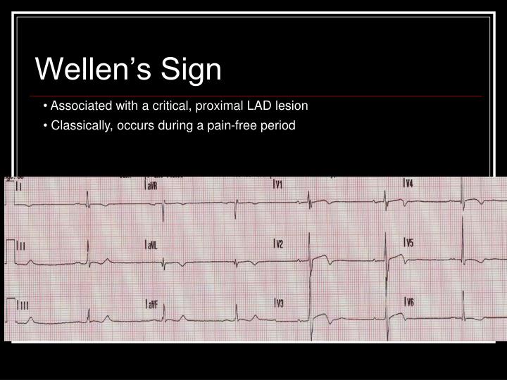 PPT - Top Ten (or 11) EKG Killers PowerPoint Presentation - ID:296841