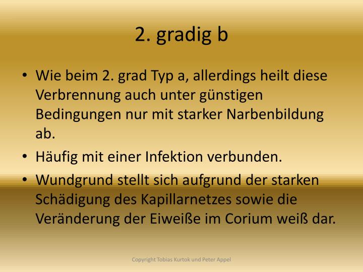 PPT - Verbrennungen PowerPoint Presentation - ID:297043