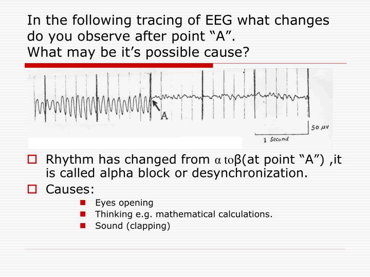 PPT - ELECTROENCEPHALOGRAPHY (EEG) PowerPoint Presentation - ID:297106