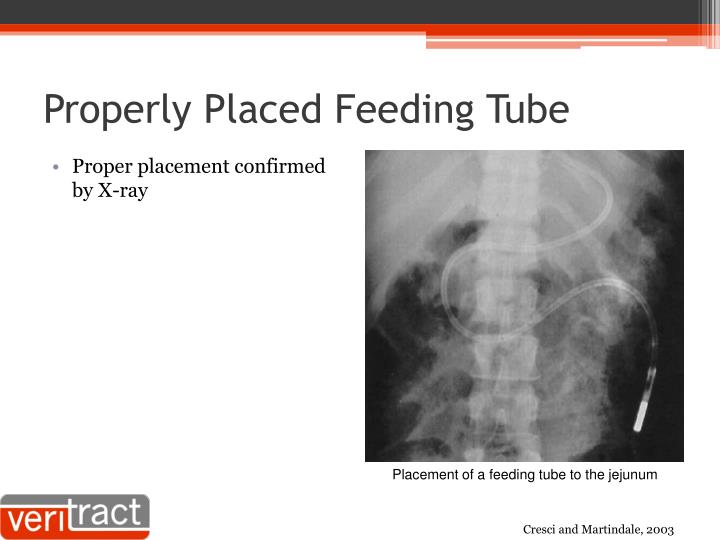 PPT - Smart Feeding Tubes PowerPoint Presentation - ID:297258