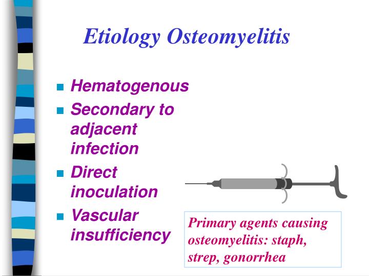 PPT - Osteomyelitis PowerPoint Presentation - ID:298370