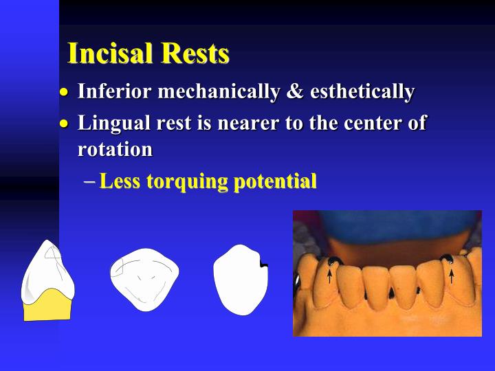 PPT - Rests & Rest Seats PowerPoint Presentation - ID:299346