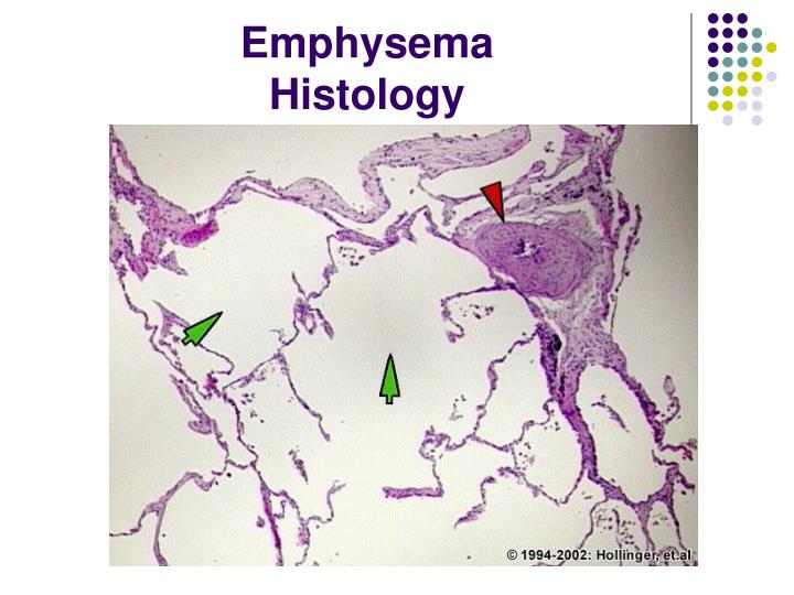 Emphysema Histology Comparison