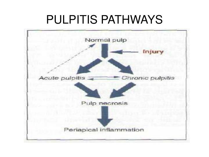 PPT - PERIAPICAL ABSCESS PowerPoint Presentation - ID:300729