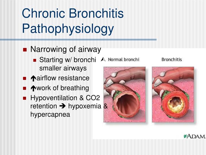 Ppt N24 Class 8 Obstructive And Inflammatory Lung Disease