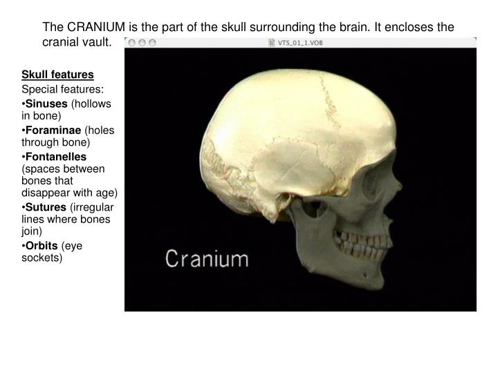PPT - The CRANIUM is the part of the skull surrounding the brain. It ...