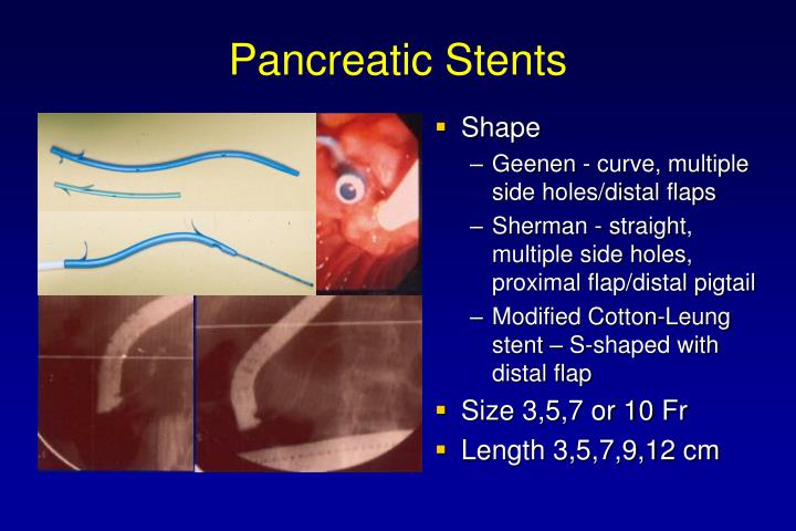 PPT - Endoscopic Stenting for Pancreatic Diseases PowerPoint ...