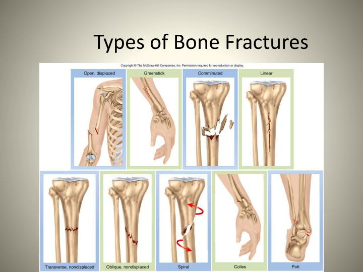 PPT - Building Your Bones:Osteogenesis PowerPoint Presentation - ID:303523