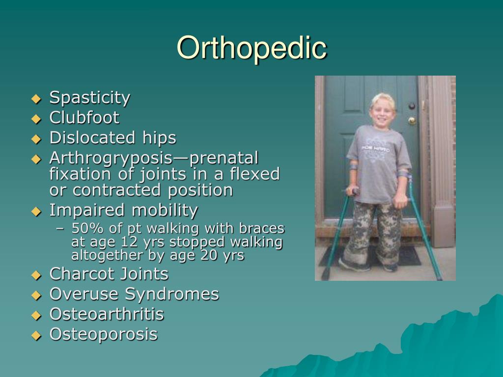 Ppt Spina Bifida Powerpoint Presentation Free Download Id 304143