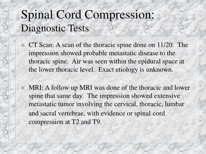 PPT - Spinal Cord Compression: A Case Study PowerPoint Presentation ...