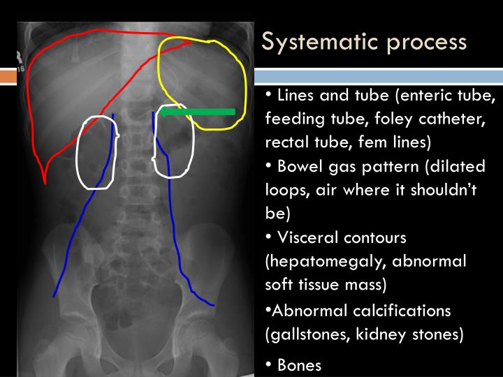 PPT - Introduction to Radiology PowerPoint Presentation - ID:307923