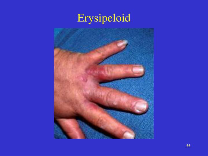 PPT - Bacterial Infections Chapter 14 PowerPoint Presentation - ID:308696