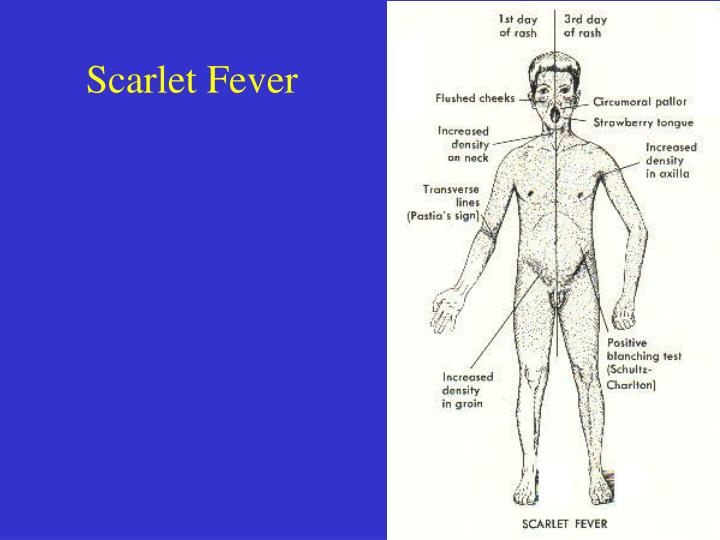PPT - Bacterial Infections Chapter 14 PowerPoint Presentation - ID:308696