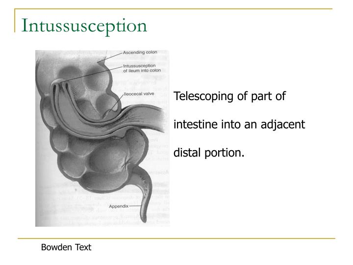 PPT - Gastrointestinal Disorders PowerPoint Presentation - ID:309493