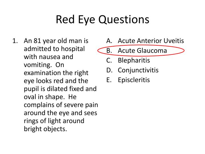 PPT - Ophthalmology for Finals -Revision Lecture PowerPoint ...