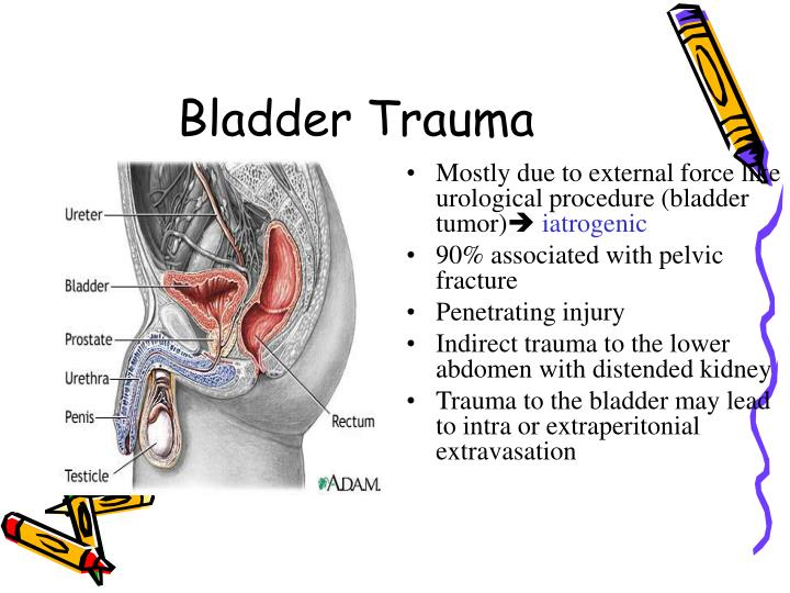 PPT - Acute Conditions in Urology & Scrotal Swellings PowerPoint ...