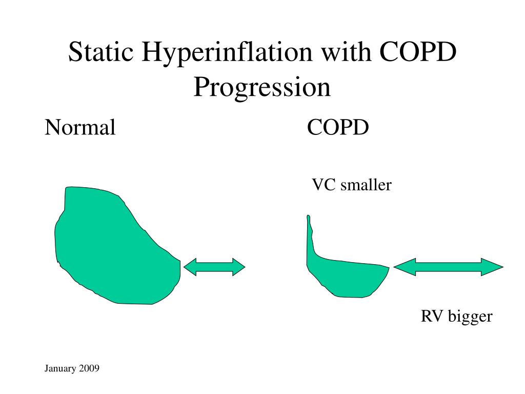 PPT - Pulmonary Function Testing Clinical Physiology PowerPoint ... PPT - Pulmonary Function Testing Clinical Physiology PowerPoint ...