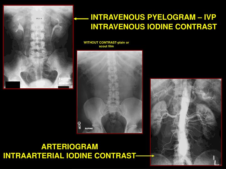 PPT - RADIOLOGY PowerPoint Presentation - ID:316796