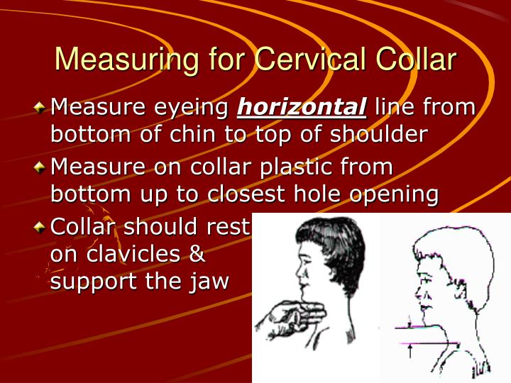 PPT - Head and Spinal Cord Trauma PowerPoint Presentation - ID:317620