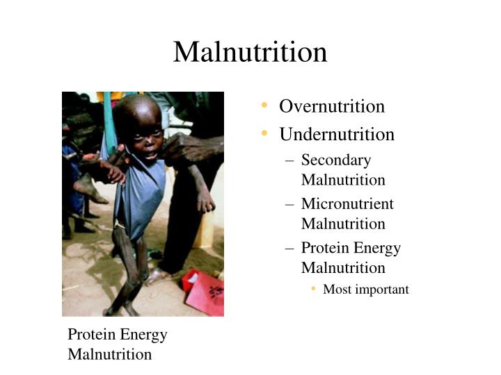 PPT - Malnutrition Defined PowerPoint Presentation - ID:318151
