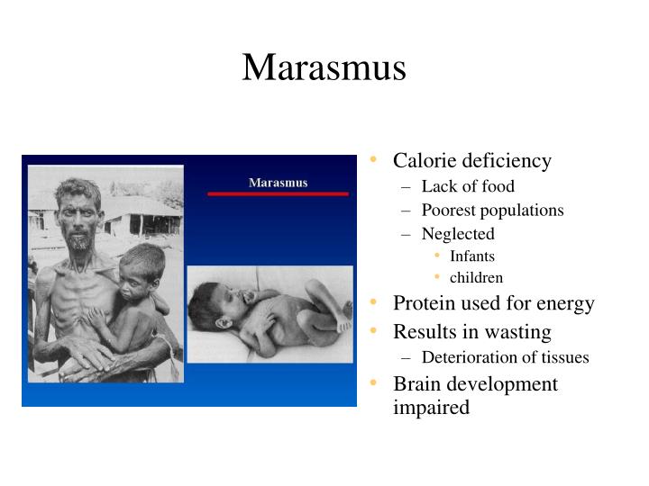 PPT - Malnutrition Defined PowerPoint Presentation - ID:318151