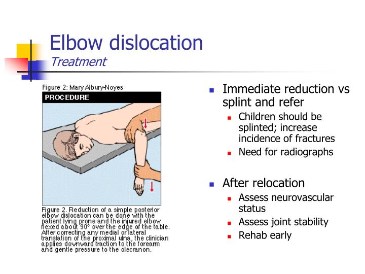PPT - Ski injuries to the upper extremities PowerPoint Presentation ...