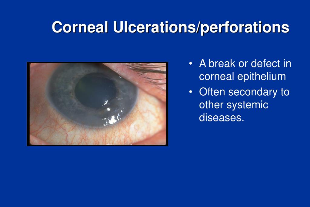 Ppt Processed Amniotic Membrane Allografts Powerpoint Presentation