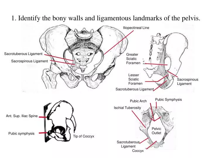PPT - Tip of Coccyx PowerPoint Presentation, free download - ID:322923