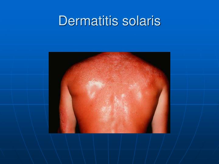 PPT - DERMATOLOGIE PowerPoint Presentation - ID:324340