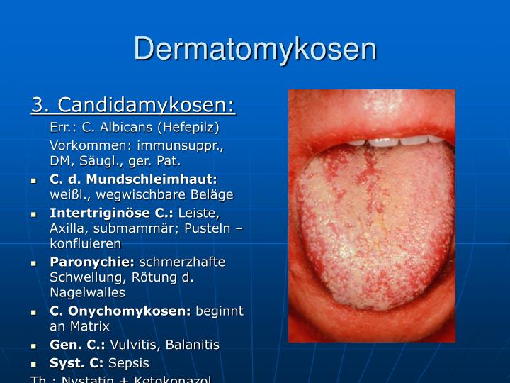 PPT - DERMATOLOGIE PowerPoint Presentation - ID:324340