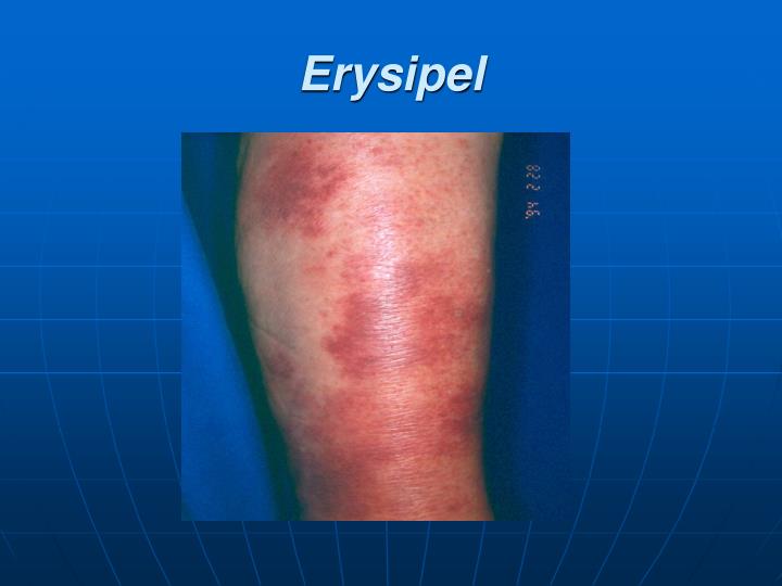 PPT - DERMATOLOGIE PowerPoint Presentation - ID:324340