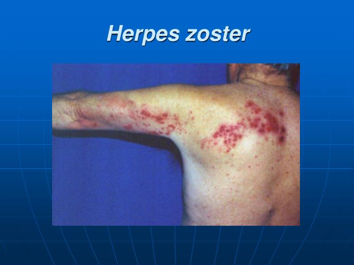 PPT - DERMATOLOGIE PowerPoint Presentation - ID:324340