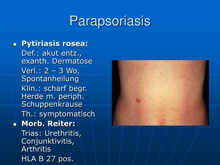 PPT - DERMATOLOGIE PowerPoint Presentation - ID:324340