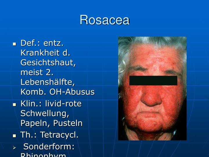 PPT - DERMATOLOGIE PowerPoint Presentation - ID:324340