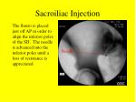 PPT - Flouro Images of Lumbar Spine Injections PowerPoint Presentation ...
