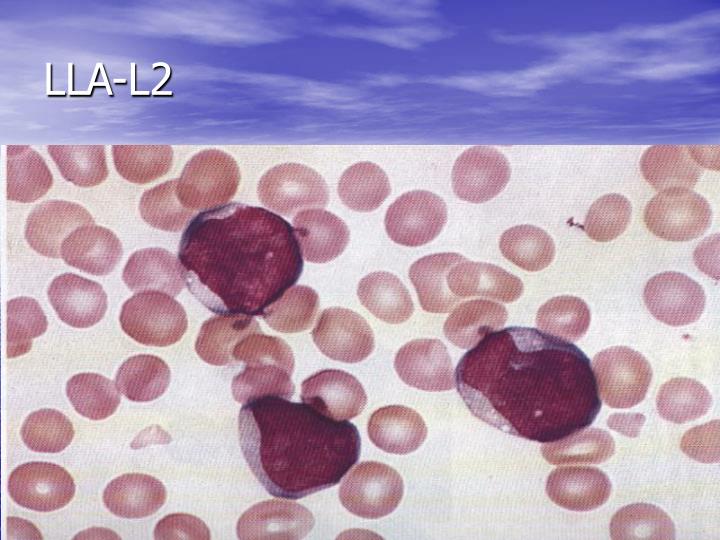 PPT - DIAGNÓSTICO DAS LEUCEMIAS PowerPoint Presentation - ID:326452