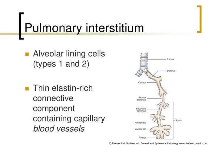 PPT - Interstitial Lung Disease PowerPoint Presentation - ID:327693