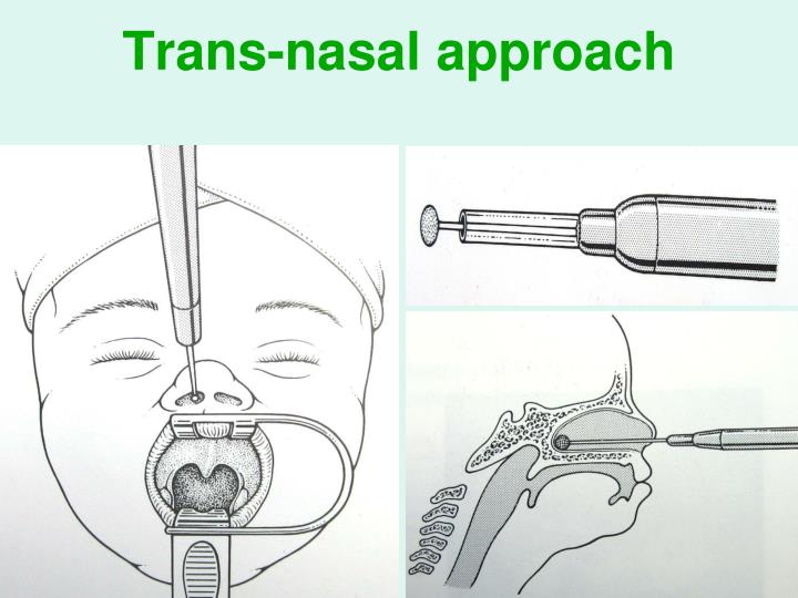 PPT - Miscellaneous Nose Topics PowerPoint Presentation - ID:328776