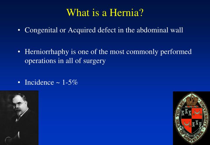 PPT - Hernia PowerPoint Presentation - ID:331353
