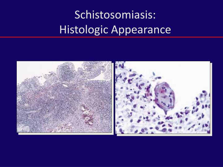 PPT - Trematodes PowerPoint Presentation - ID:336765