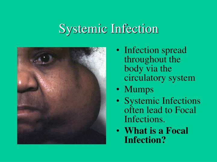 PPT - Principles of Disease PowerPoint Presentation - ID:337666