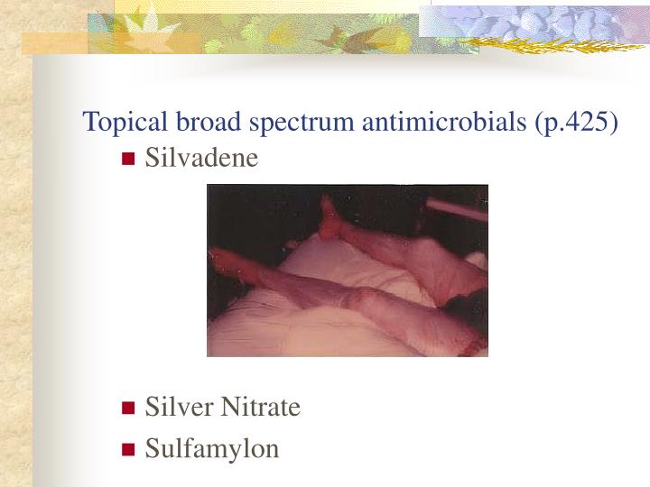PPT - Integumentary: Burns PowerPoint Presentation - ID:337965