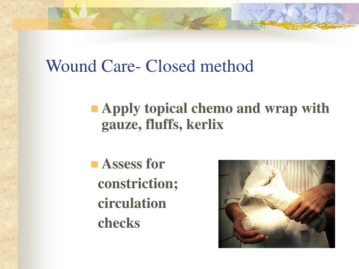 PPT - Integumentary: Burns PowerPoint Presentation - ID:337965