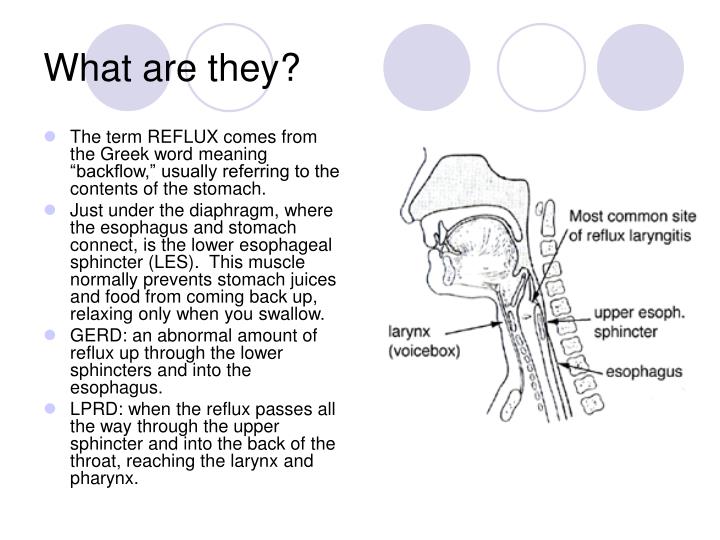PPT - Gastroespohageal Reflux Disease (GERD) & Laryngopharyngeal Reflux ...