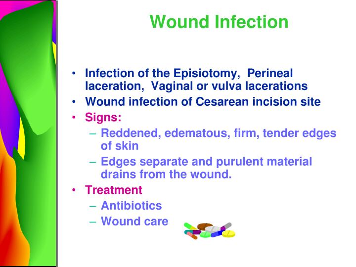 PPT - Complications Of Postpartum PowerPoint Presentation - ID:343782