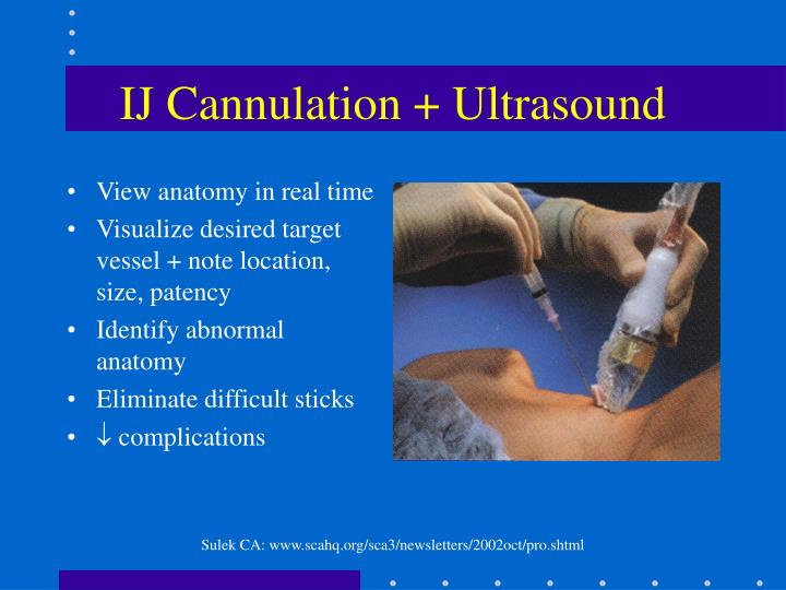 PPT - Thoracic Aorta Trauma PowerPoint Presentation - ID:343987