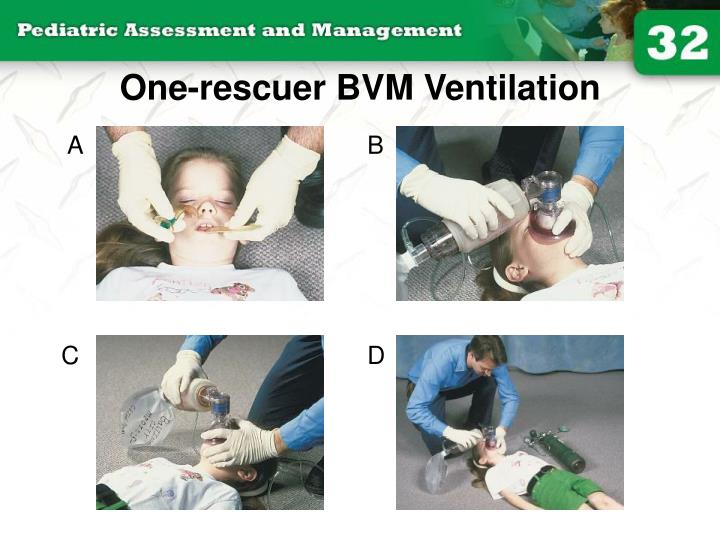 PPT - 32: Pediatric Assessment and Management PowerPoint Presentation ...
